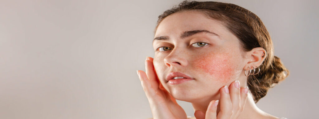 Facial Thread Veins: Causes, Concerns, and Expert Solutions