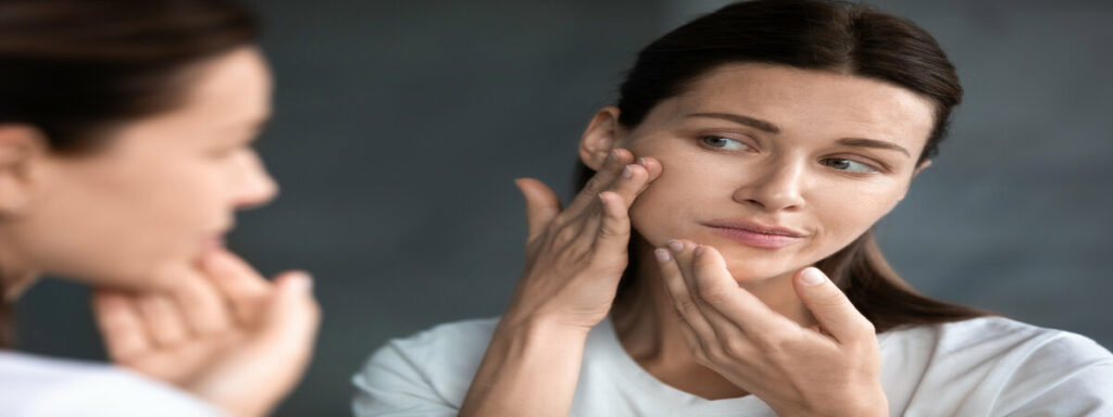 Expert Tips for Dry Skin Relief